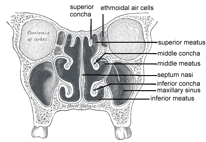 Paranasal sinus cancer